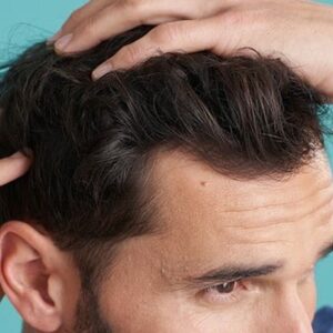 Swelling Back Of The Head After Hair Transplant in Dubai & Abu Dhabi