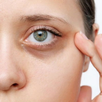 How To Get Rid Of Eye Bags And Keep Face Looking Youthful